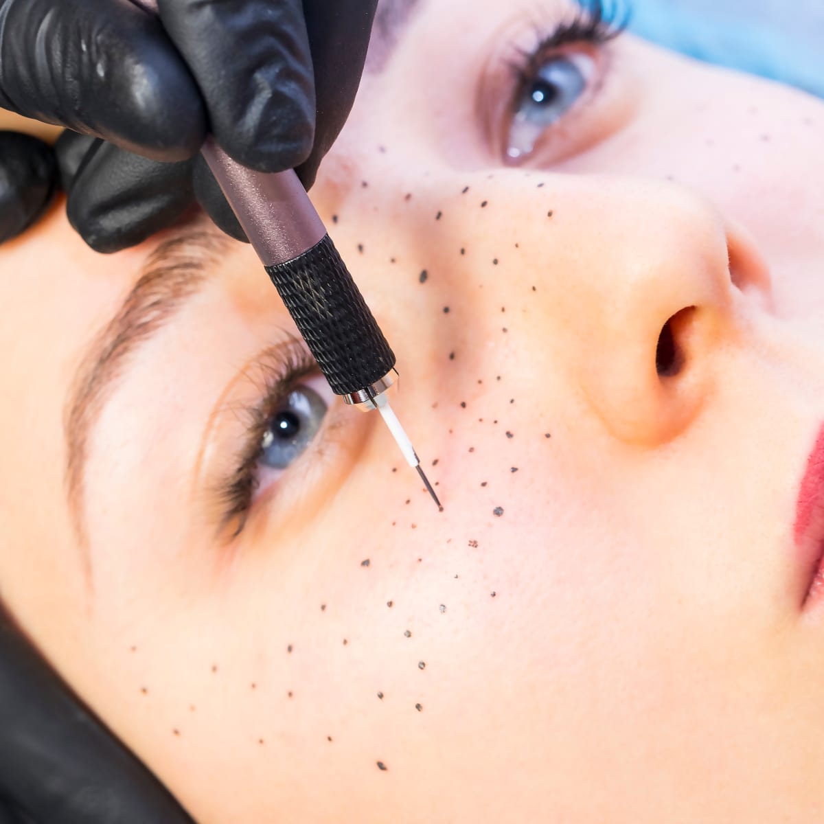 FRECKLE TATTOOS IN HEALTH AND SKINCARE / SOMATOLOGY / BEAUTY AND NAILS ...